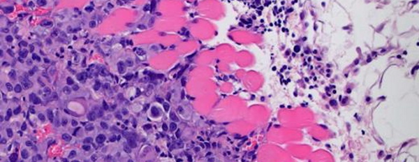 SFARI Gene: an evolving database for the autism research community ...