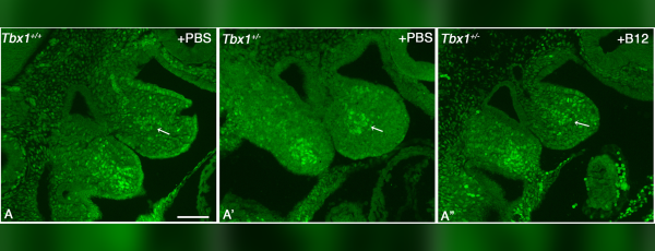 SFARI Gene: an evolving database for the autism research community ...