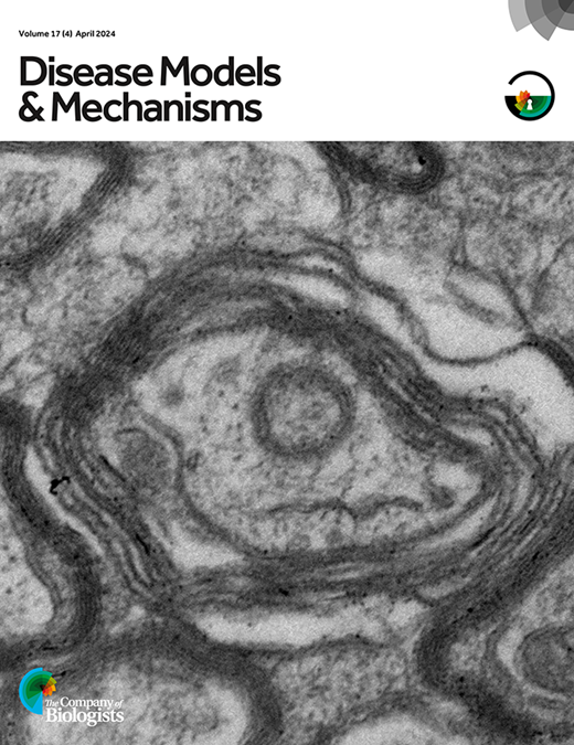 Keeping an eye on HIF-1α in age-related macular degeneration | Disease ... Keeping an eye on HIF-1α in age-related macular degeneration | Disease ...
